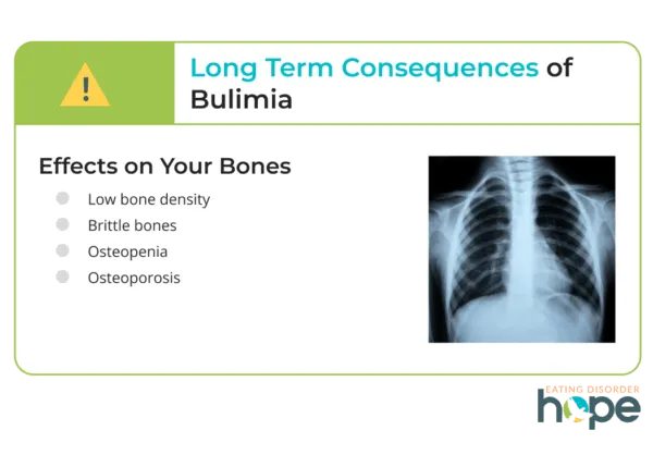 bulimia effects