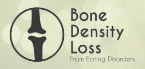 Early Onset Osteoporosis due to Bone Loss From Eating Disorders